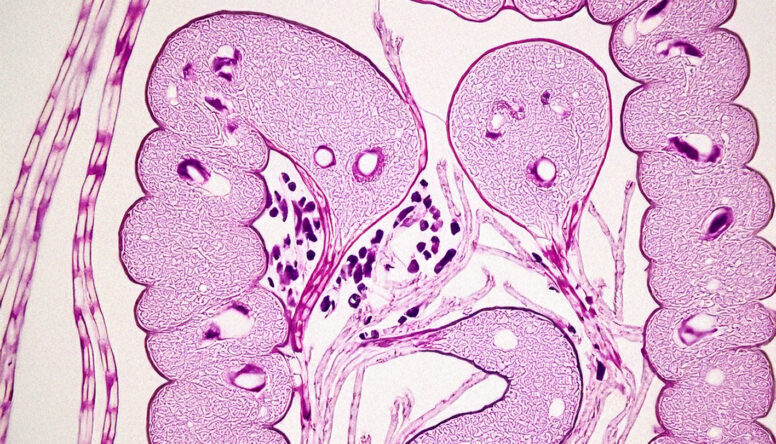 Polyps & Cysts Diagnosis and Treatment | The New Foscote Hospital